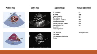 Normal Echocardiogram. Based on cardiac studies | PPT