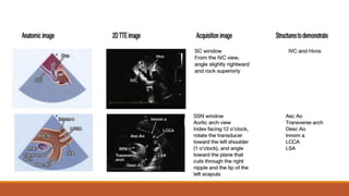 Normal Echocardiogram. Based on cardiac studies | PPT