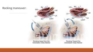 Normal Echocardiogram. Based on cardiac studies | PDF