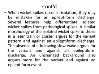EEG Variants By IM | PPTX
