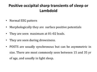 Normal eeg variants by faizan abdullah | PPT