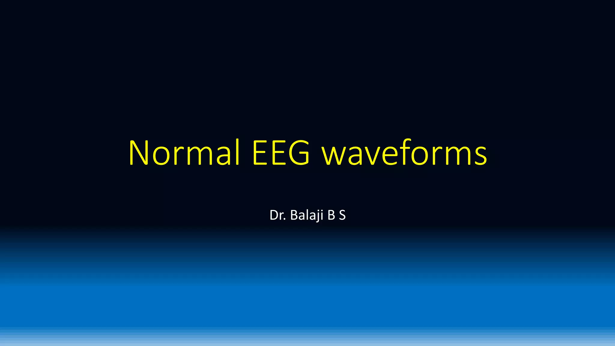 Normal Eeg Waveformspptx Brain And Nervous System Disorders