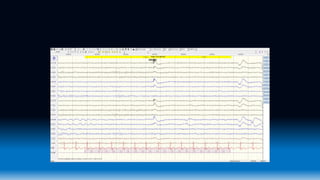 Normal EEG waveforms.pptx