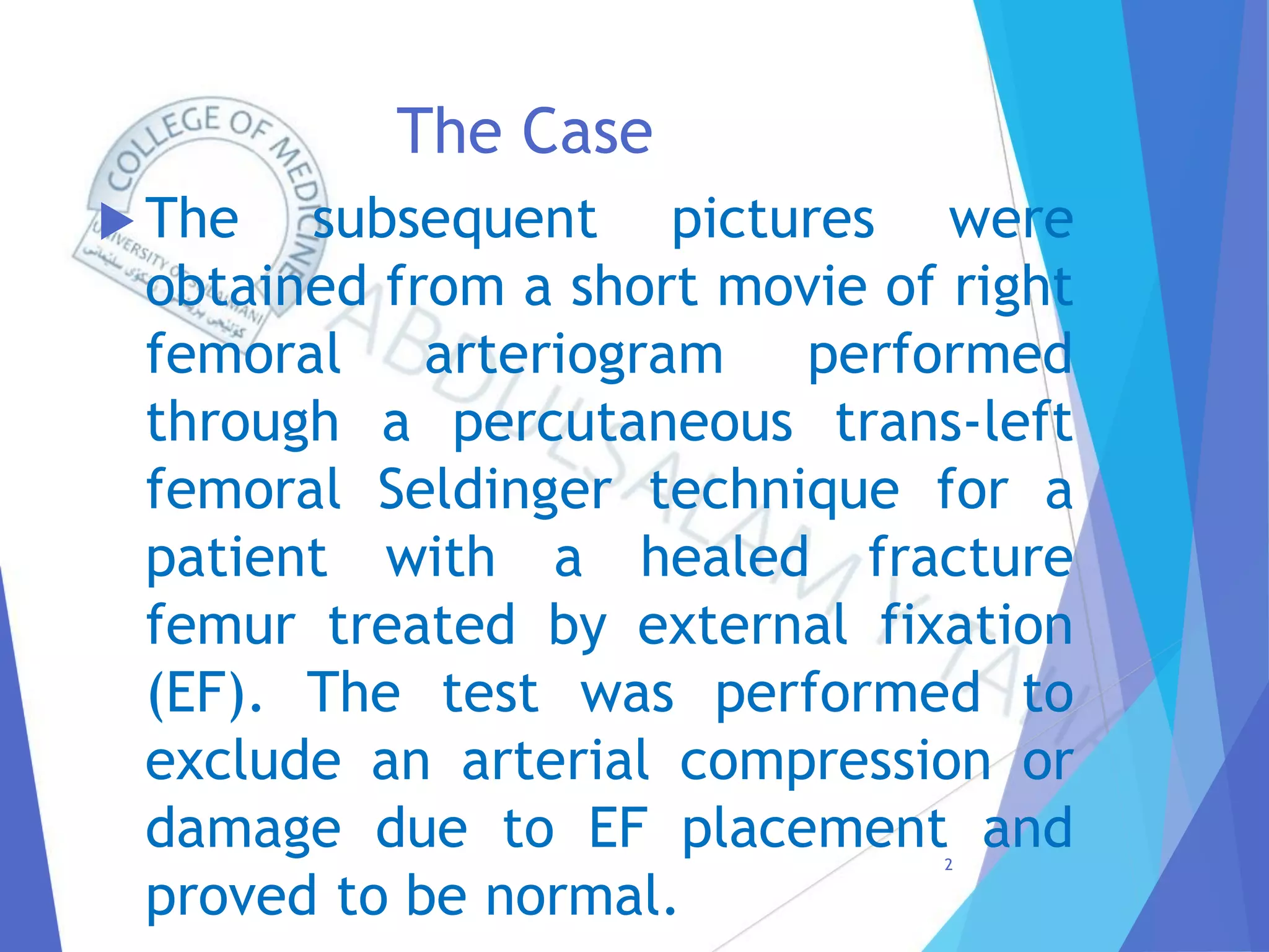 Normal Femoral Arteriogram in a Patient with Fracture femur and ...