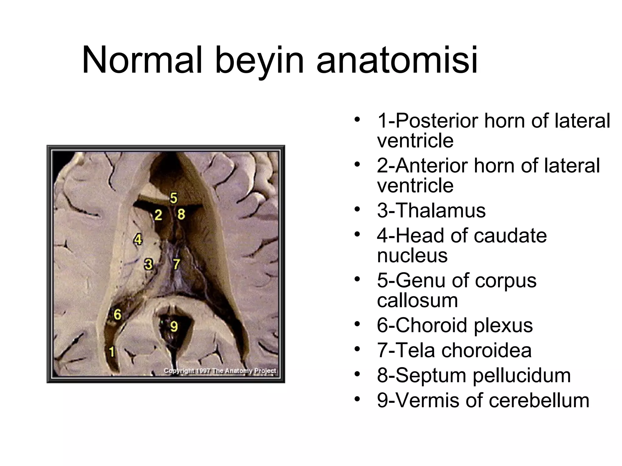 Normal fetal beyin nasildir | PPT | Pregnancy | Reproductive Health