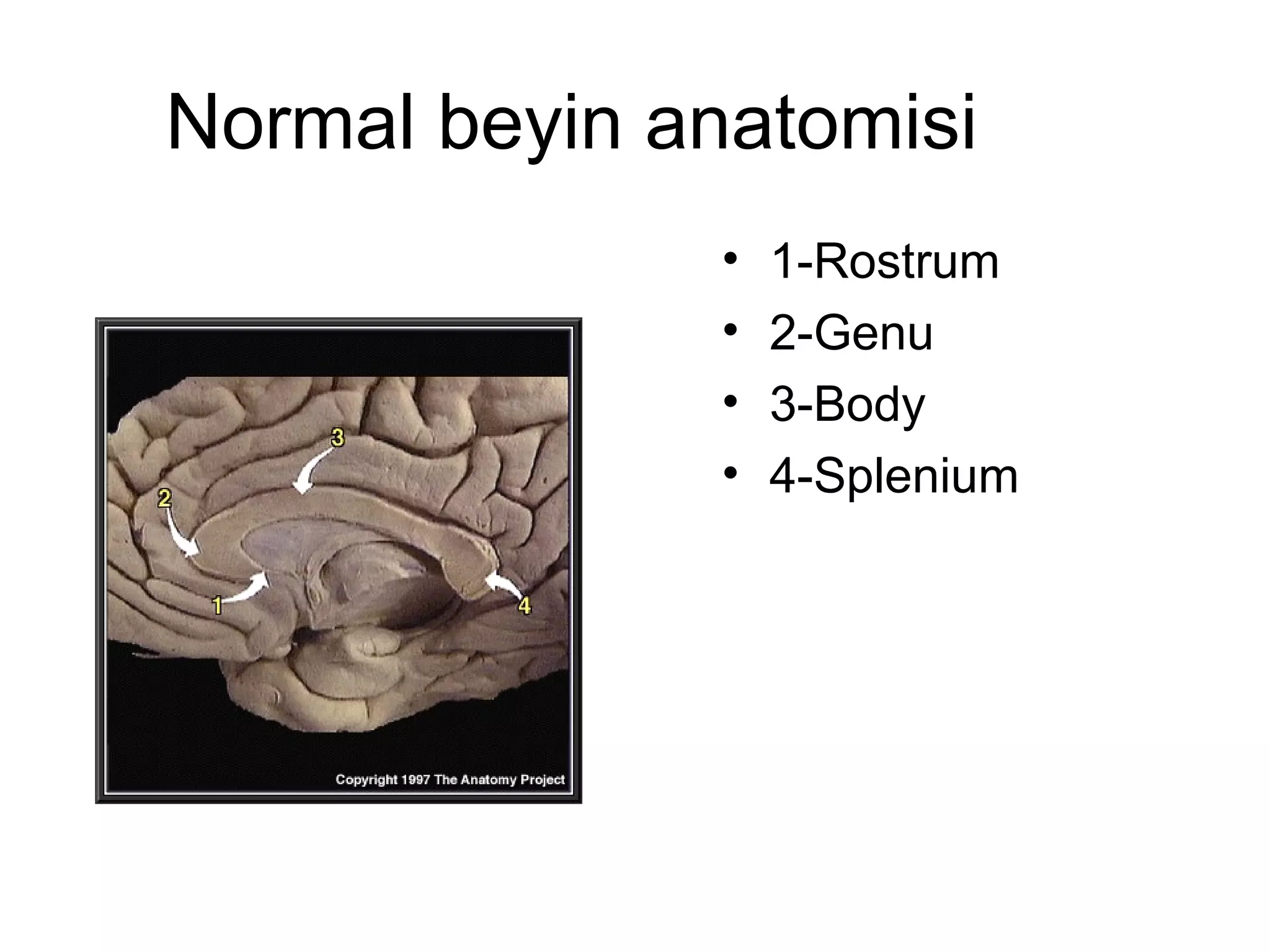 Normal fetal beyin nasildir | PPT