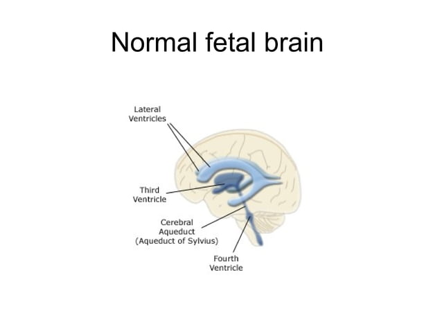 Normal fetal beyin nasildir | PPT