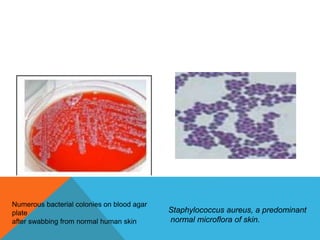 Normal flora of Skin | PPTX