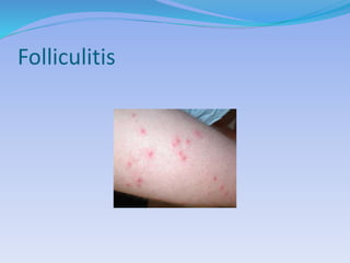 Normal flora of skin | PDF