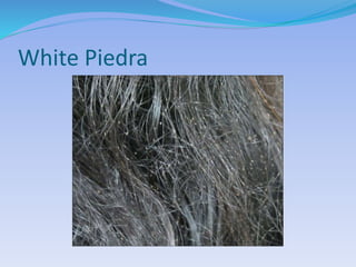 Normal flora of skin | PDF