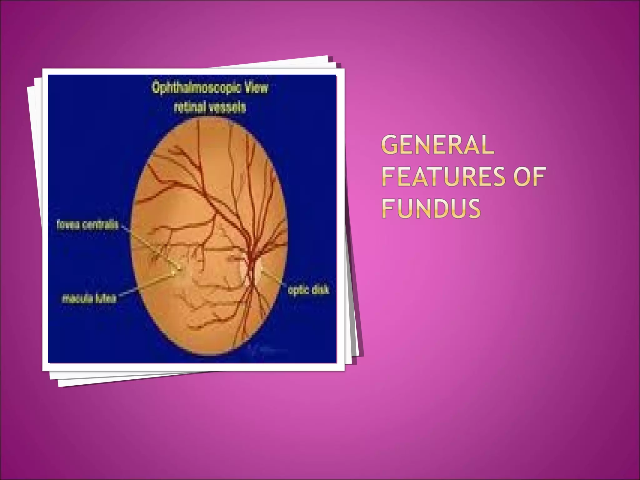 Normal fundus | PPT