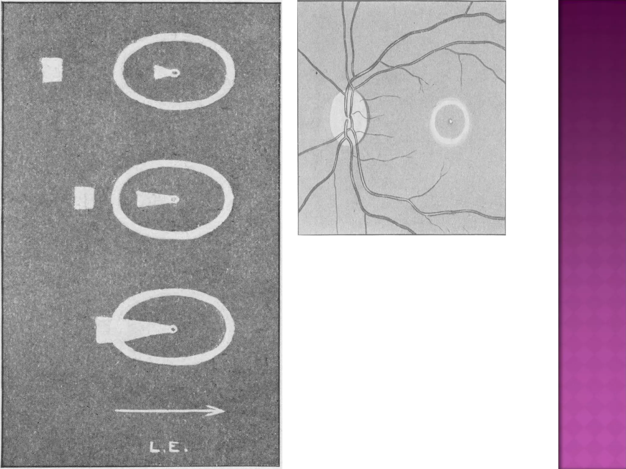 Normal fundus | PPT