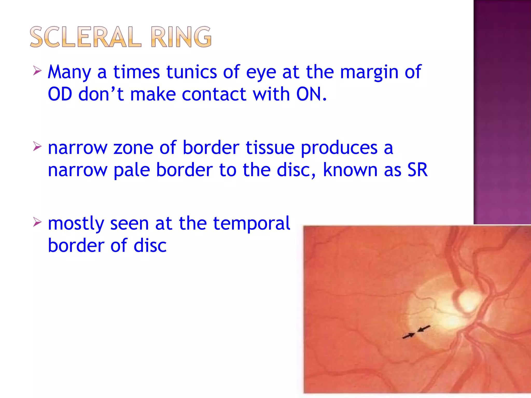 Normal fundus | PPT