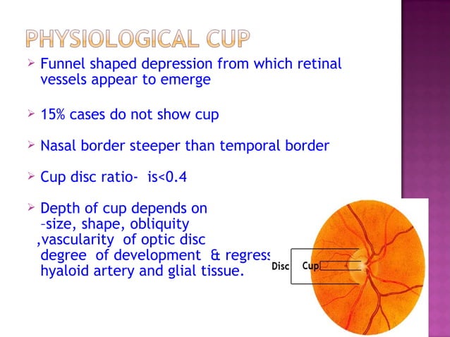 Normal fundus | PPT | Eye and Vision Conditions | Diseases and Conditions