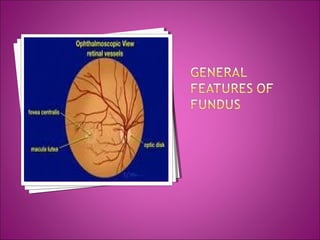 Ocular Fundus Labeled