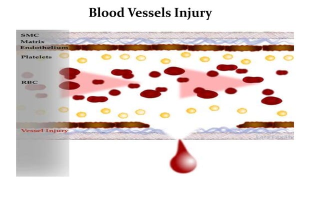 Normal haemostasis | PPTX