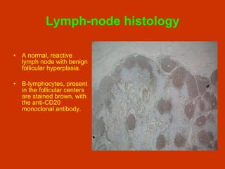 Normal Hematopoiesis | PPT