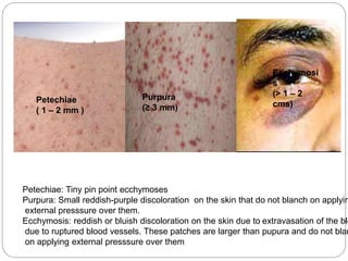 Normal hemostasis.pptx