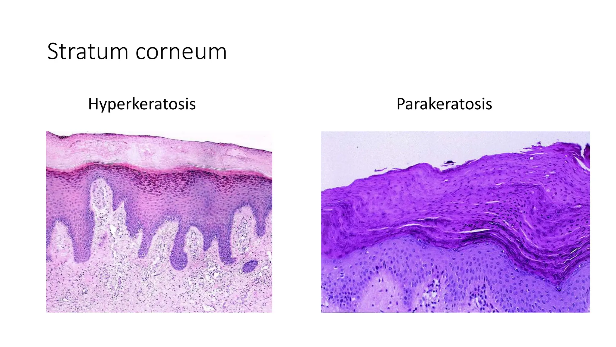 Normal histology of skin with pathological skin conditions.pptx