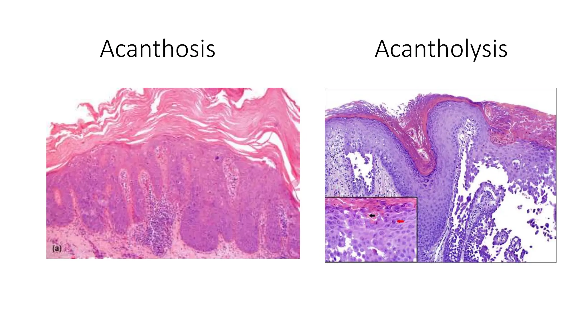 Normal histology of skin with pathological skin conditions.pptx