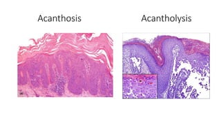 Normal histology of skin with pathological skin conditions.pptx