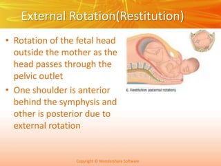 Normal labor | PPT