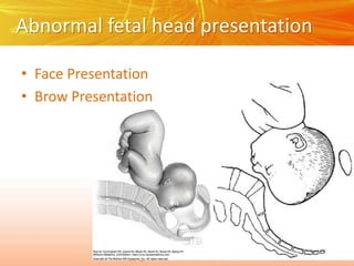 Normal labor | PPT