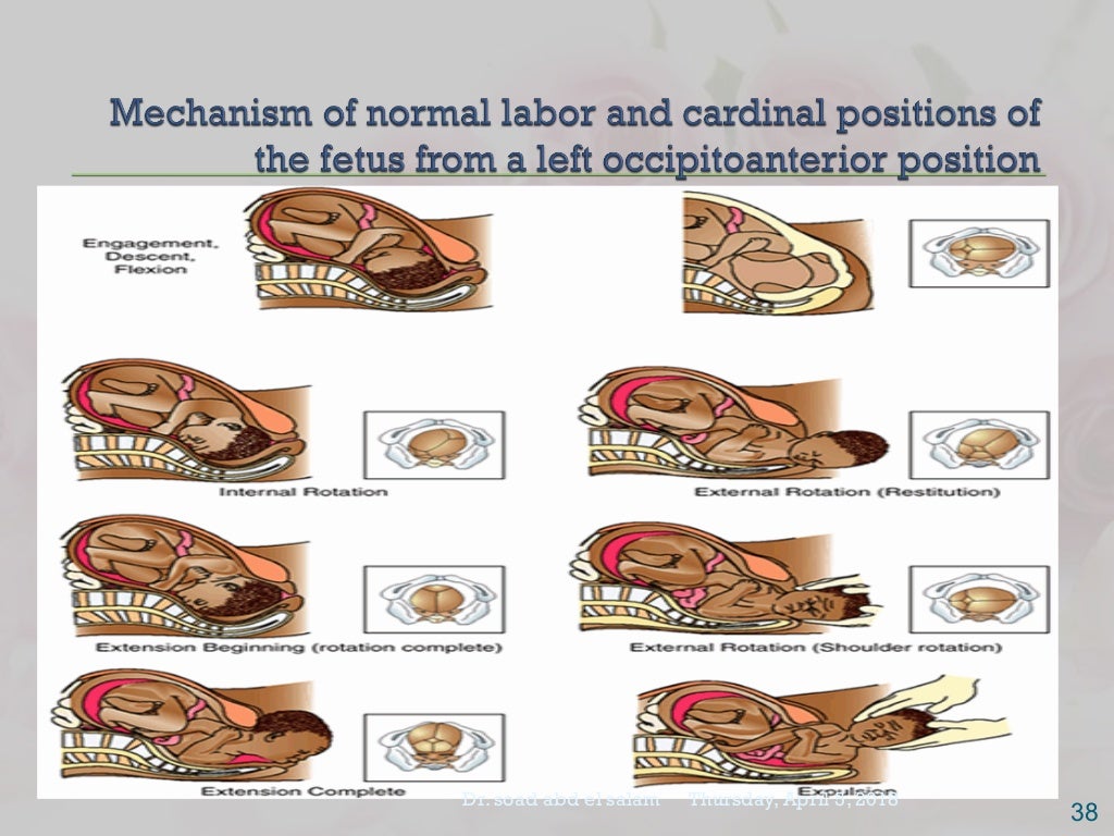 (Normal labor) .ppt
