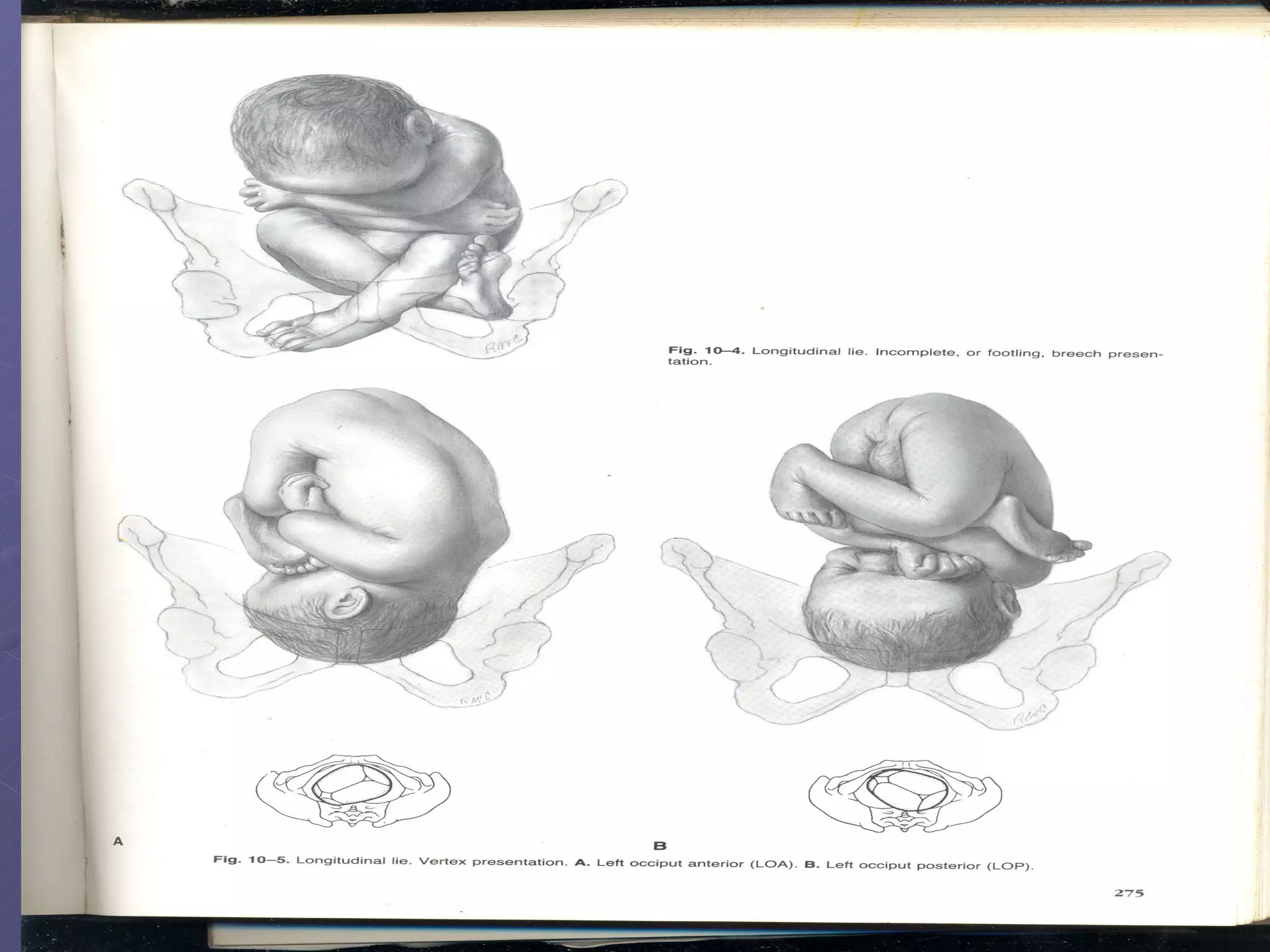 Normal Labor And Delivery | PPT