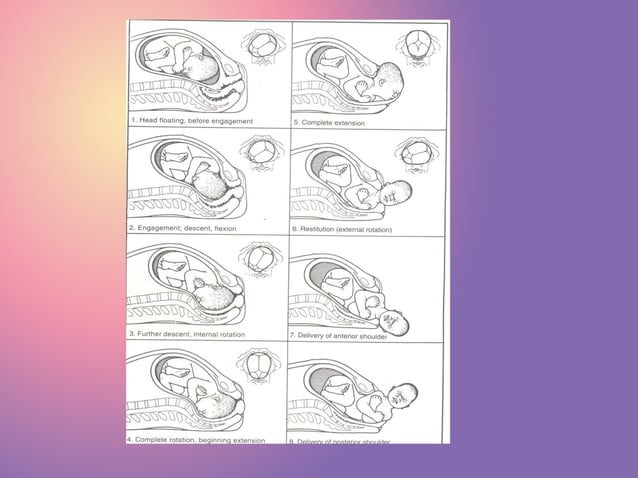 Normal Labor And Delivery | PPT | Pregnancy | Reproductive Health