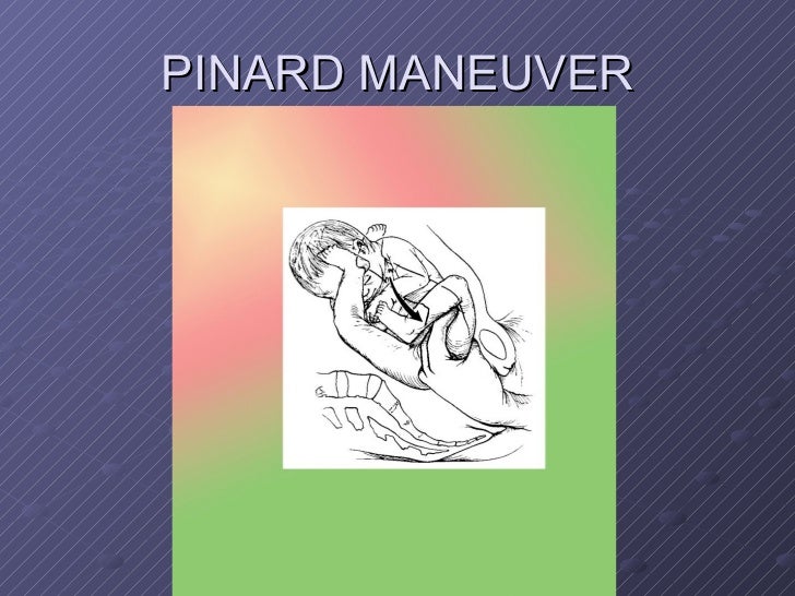 Normal Labor And Delivery