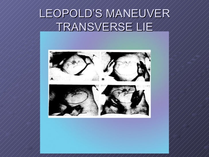 Normal Labor And Delivery