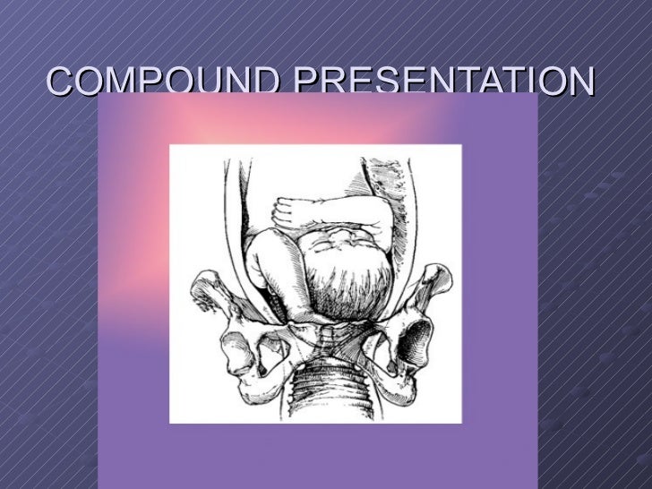 Normal Labor And Delivery