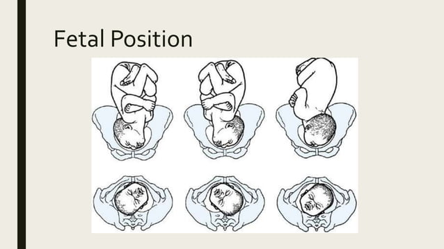 Normal labor and delivery | PPT