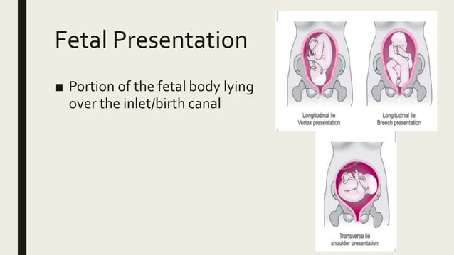 Normal labor and delivery | PPT