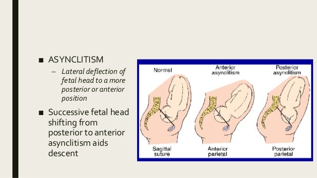 Normal labor and delivery