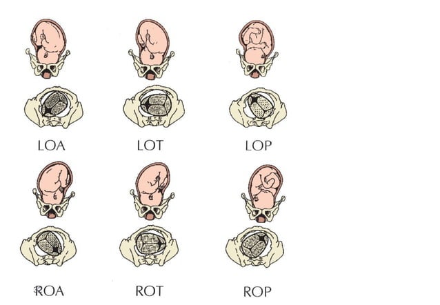 Normal Labor and Delivery Dr. Biruk lulseged.pptx