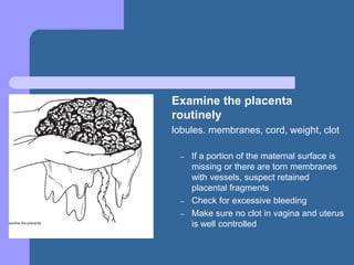 Normal Labor II.ppt