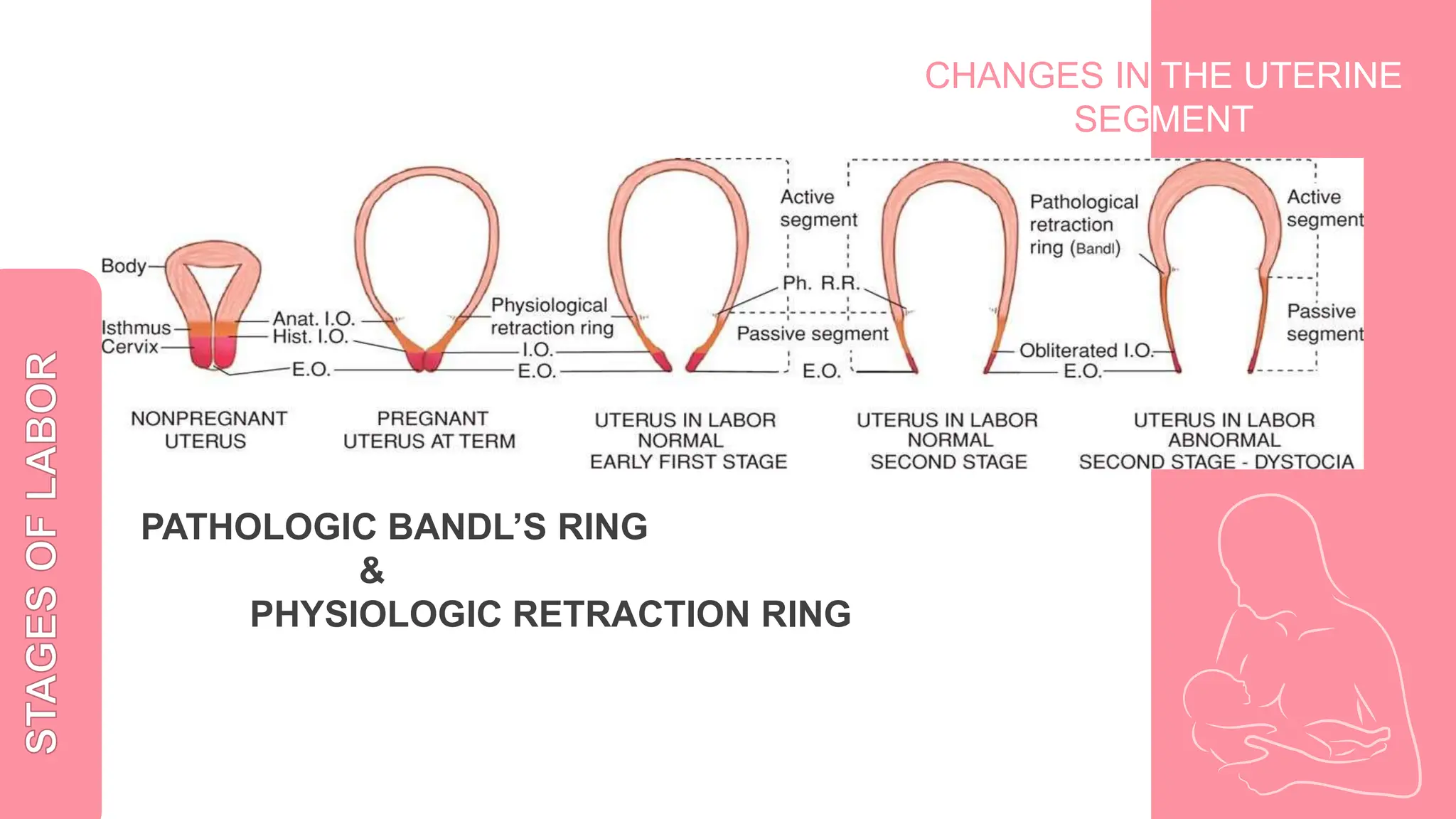 Normal Labor based on William's Obstetrics | PPTX