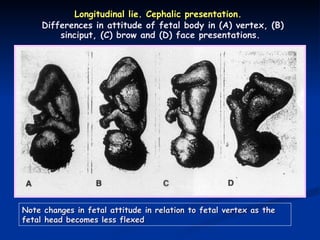Normal labor paramedics | PPT