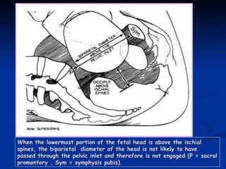 Normal labor paramedics | PPT