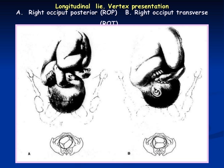 Normal labor paramedics