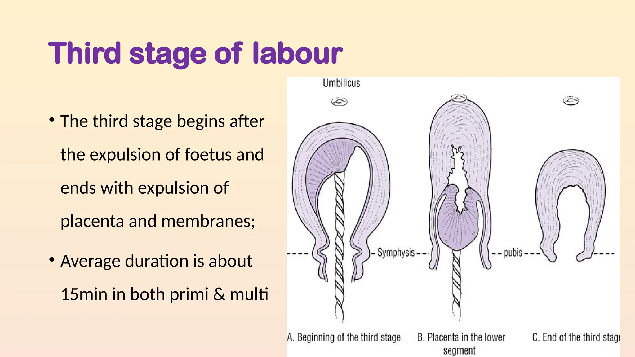normal labour.pptx labour and its stages | PPT