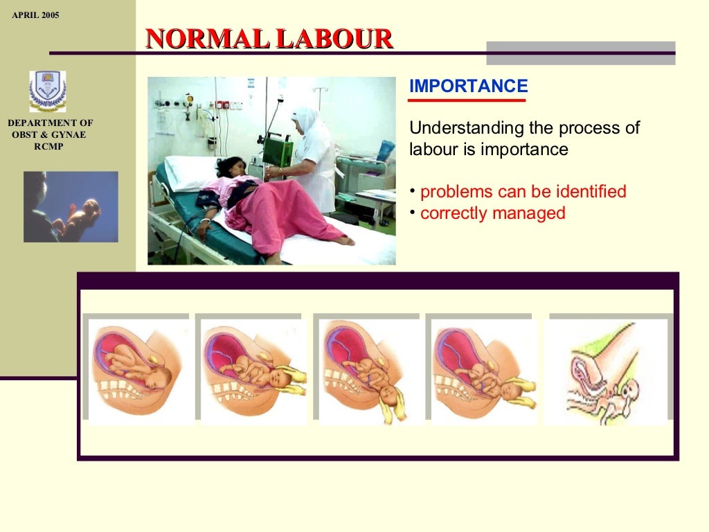 Normal labour and delivery