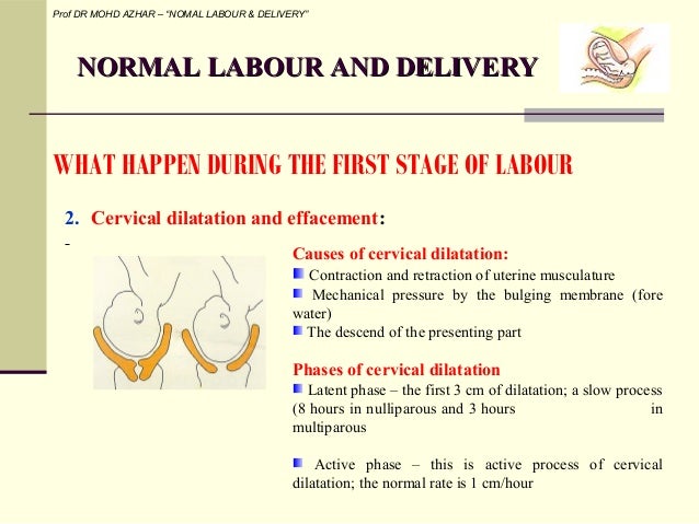 Normal labour and delivery