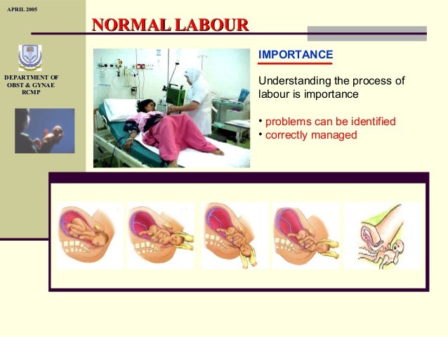 Normal labour and delivery
