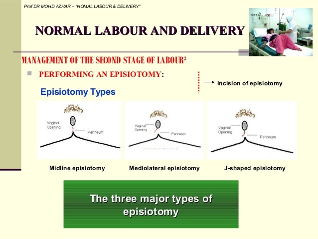 Normal labour and delivery