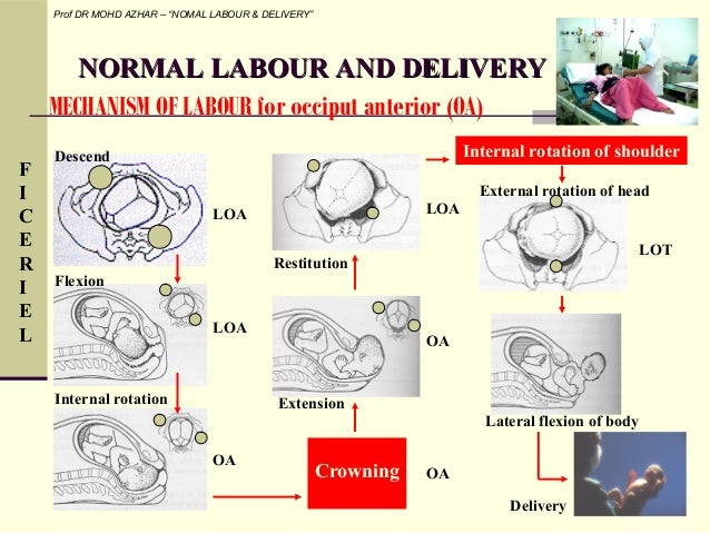 Normal labour and delivery