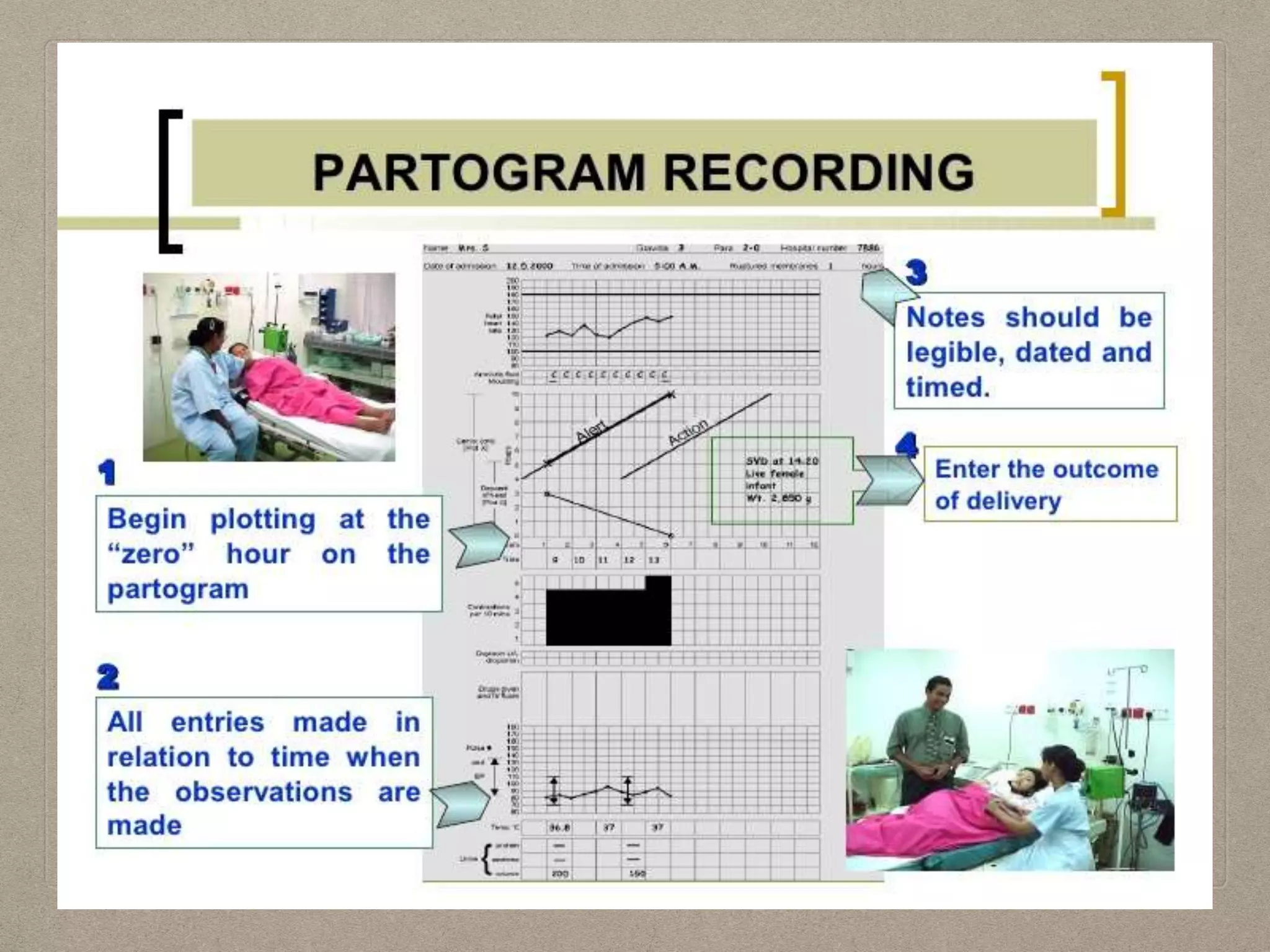 Normal labour and delivery ppt | PPTX