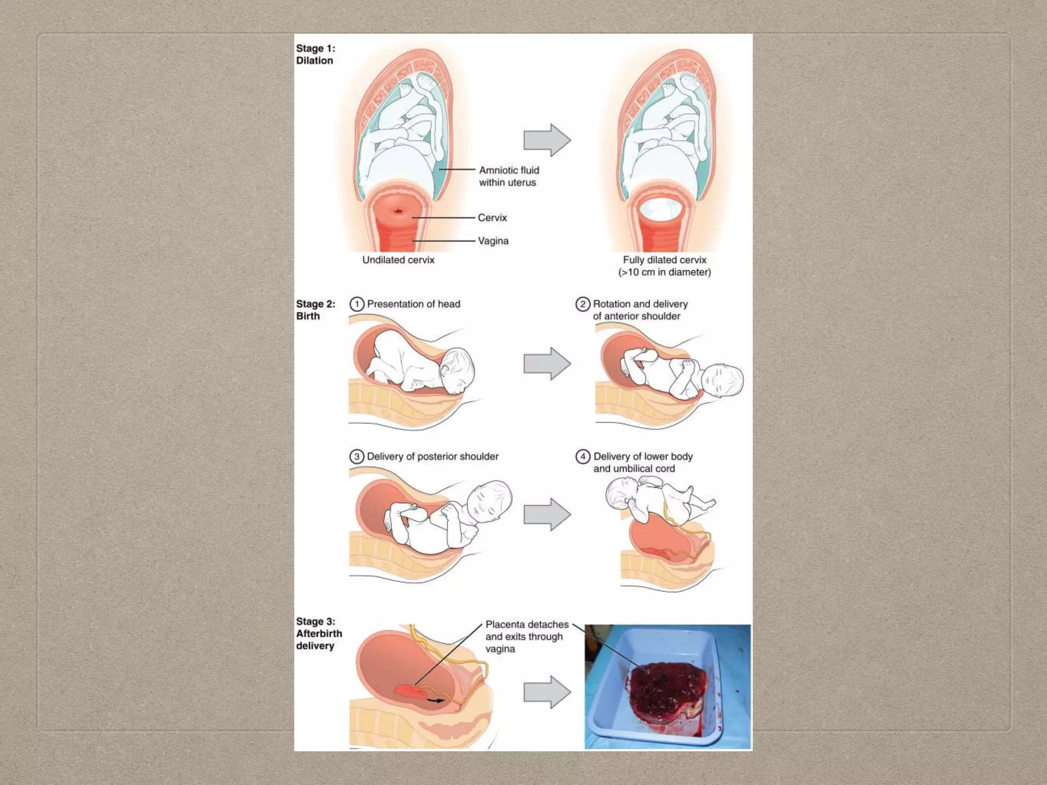 Normal labour and delivery ppt | PPTX